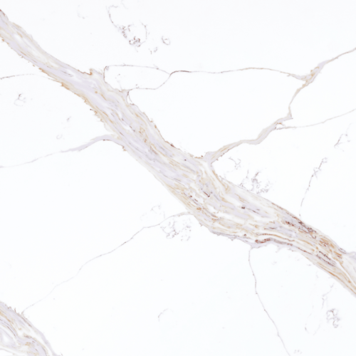 Fountain Gold Quartz | Elegant Gold Quartz in Dallas